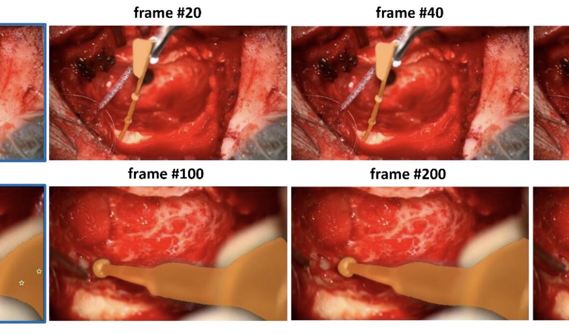 基于 SAM-2 自动识别和分割外科手术视频中的手术工具 – XiaoHu.AI学院